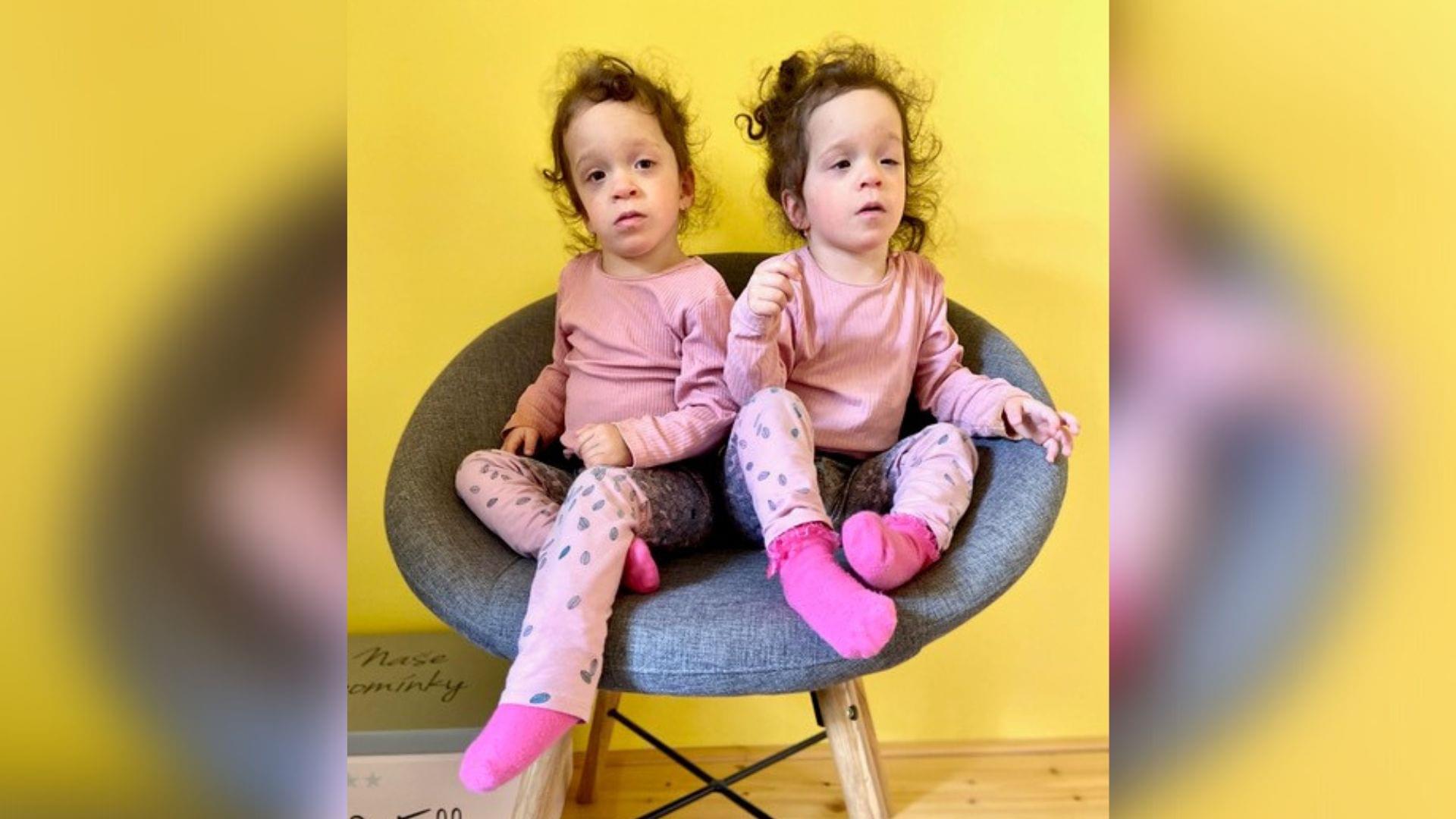 Help for Emma and Ella: sick twin girls